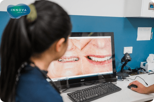 Same Day Crowns for Teeth | Transform Your Smile with Innova Dental